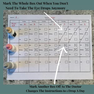 Cataract Eye Drop Schedule for Cataract Surgery Medication Tracker Eye ...