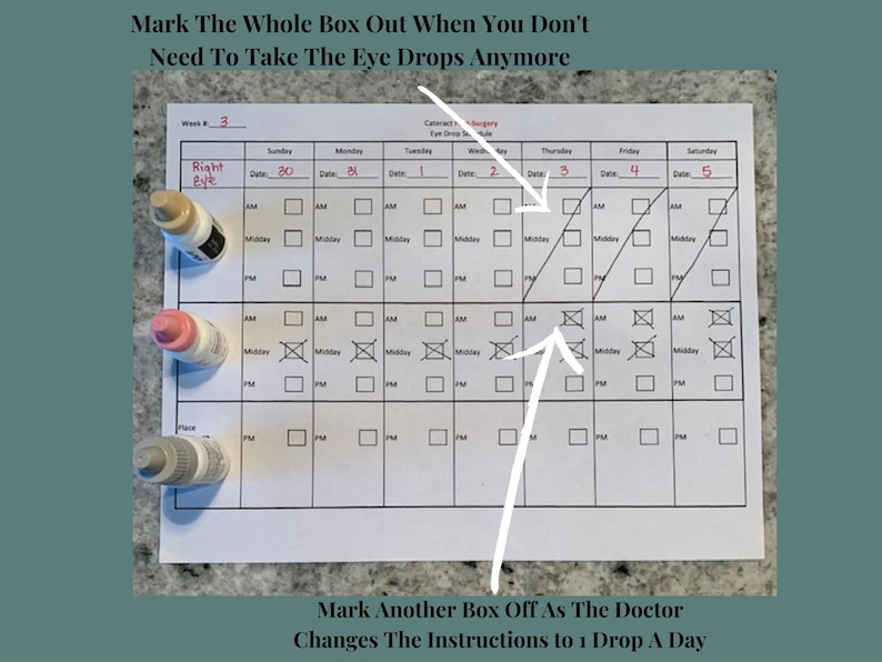 Cataract Eye Drop Schedule for Cataract Surgery Medication Tracker Eye ...