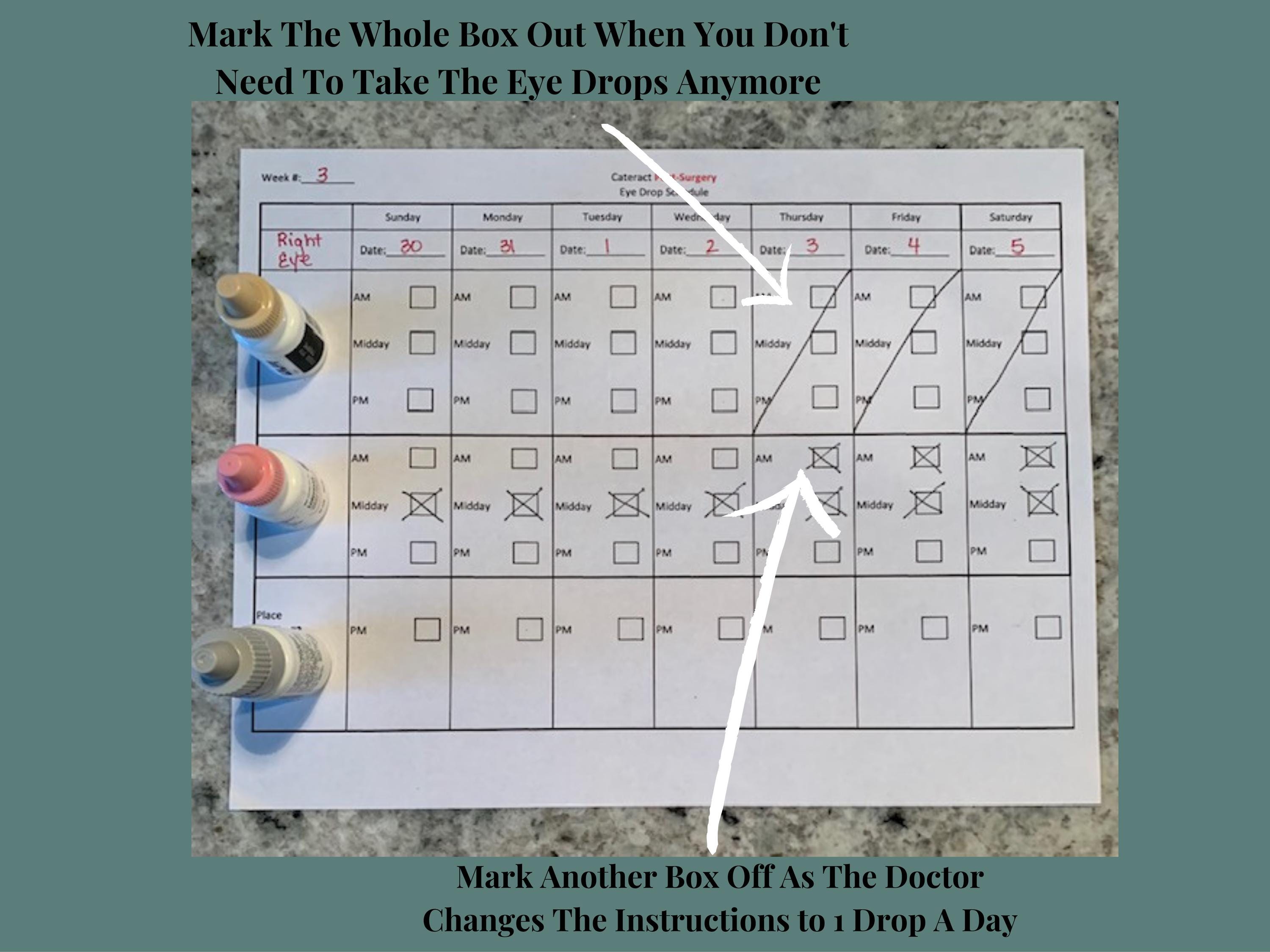 Cataract Eye Drop Schedule for Cataract Surgery Medication Tracker Eye ...
