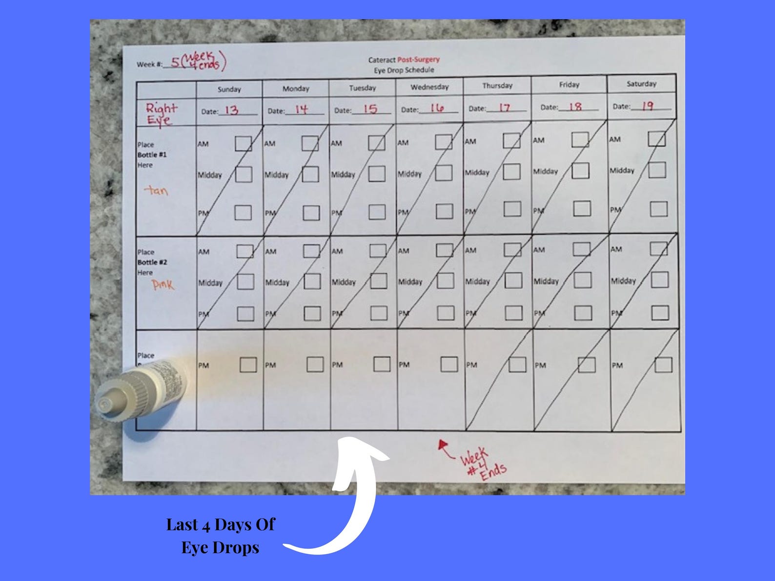 Eyedrop Cataract Surgery Eye Drop Tracker Eye Drop Schedule for ...