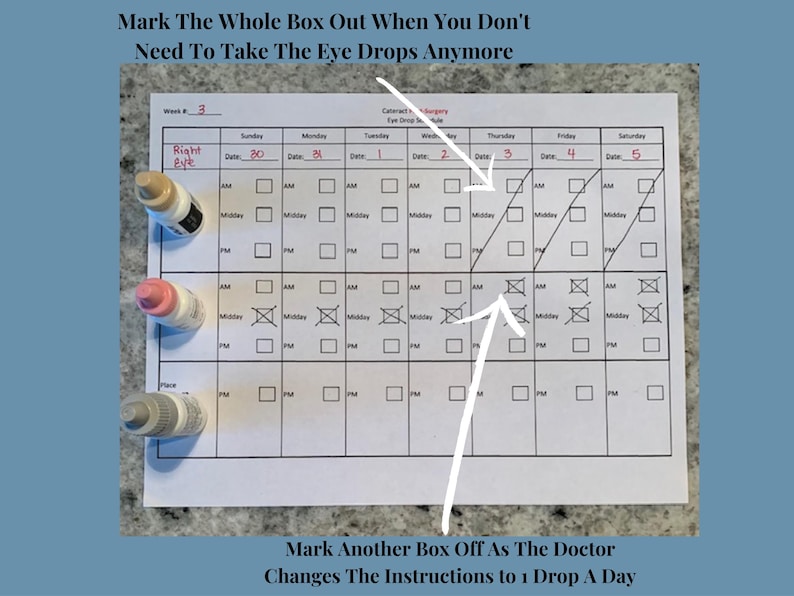 Cataract Eye Drop Schedule for Cataract Surgery Medication Tracker Eye ...