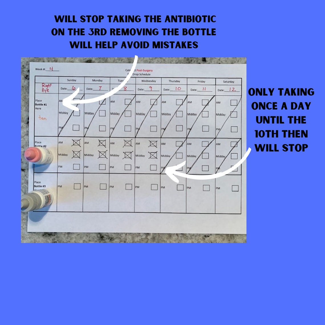 Cataract Surgery Eye Drop Tracker Eye Drop Schedule for Cataract ...