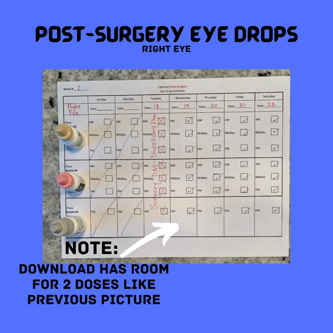 Eyedrop Cataract Surgery Eye Drop Tracker Eye Drop Schedule for ...