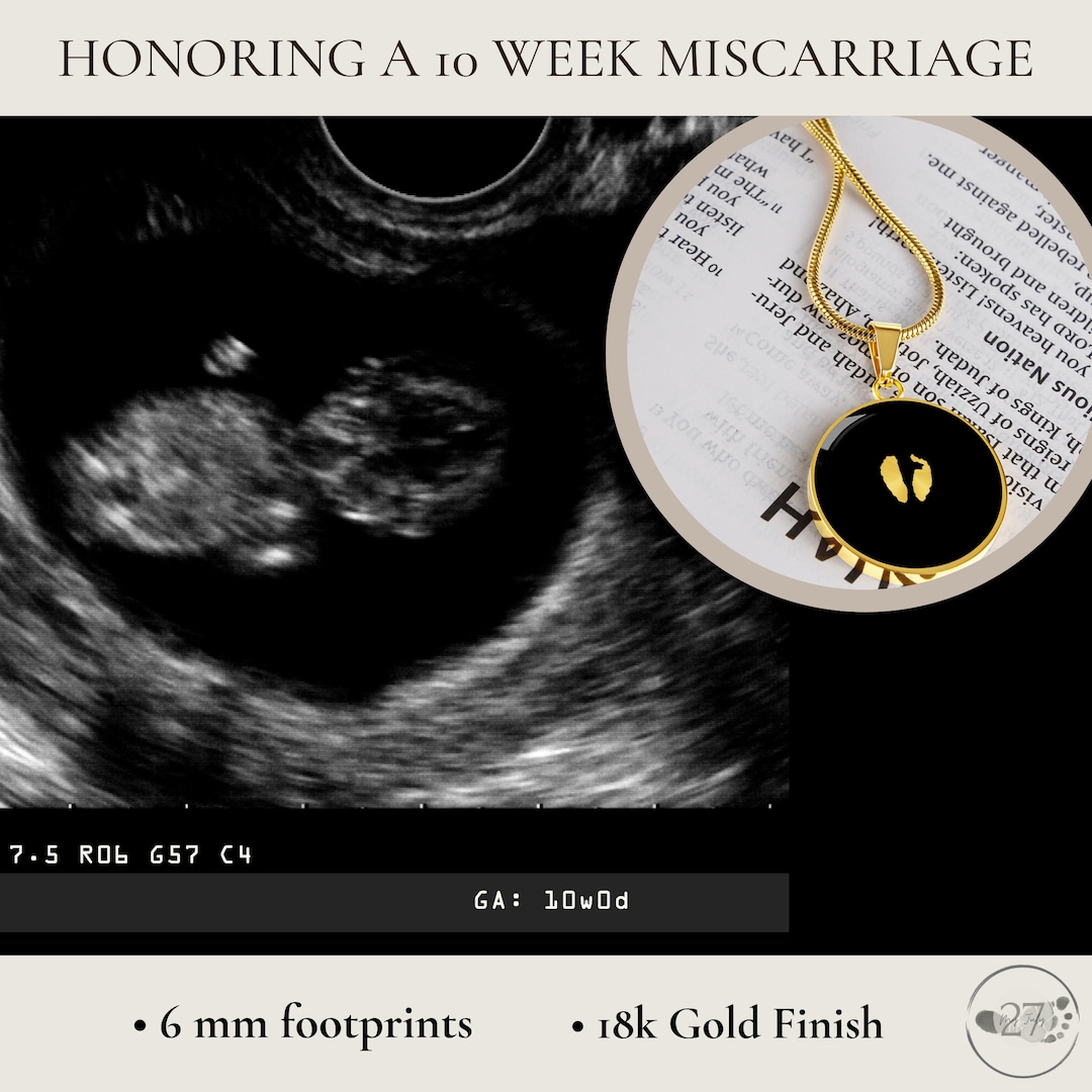 Miscarriage at 10 Weeks | 10 Week Miscarriage Keepsake Necklace ...