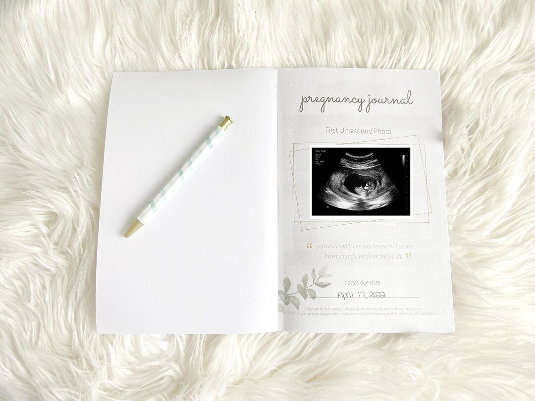 Pregnancy Journal, Mom to Be Journal, Pregnancy Memory Book for ...