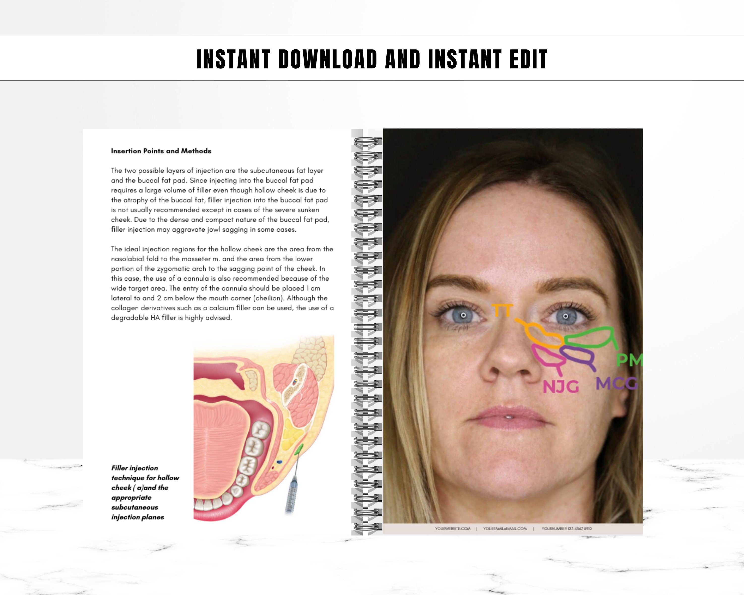 Advanced Cheek Augmentation Training Manual, Complete Guide, Fillers ...