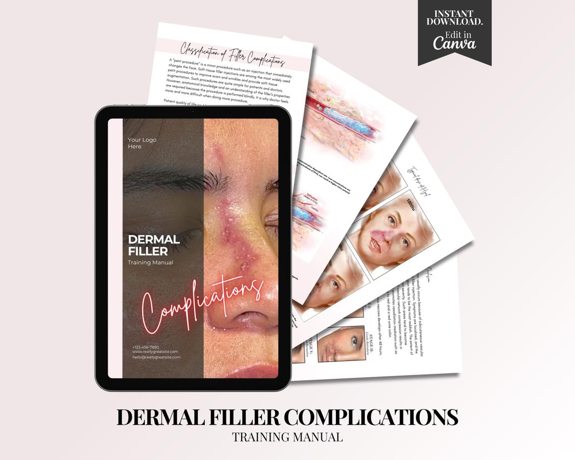 Dermal Filler Complications Training Manual: Hyaluronic Acid Injections ...