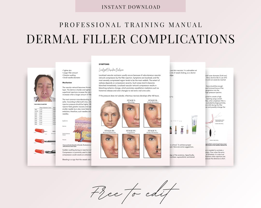 Dermal Filler Complications Training Manual: Hyaluronic Acid Injections ...