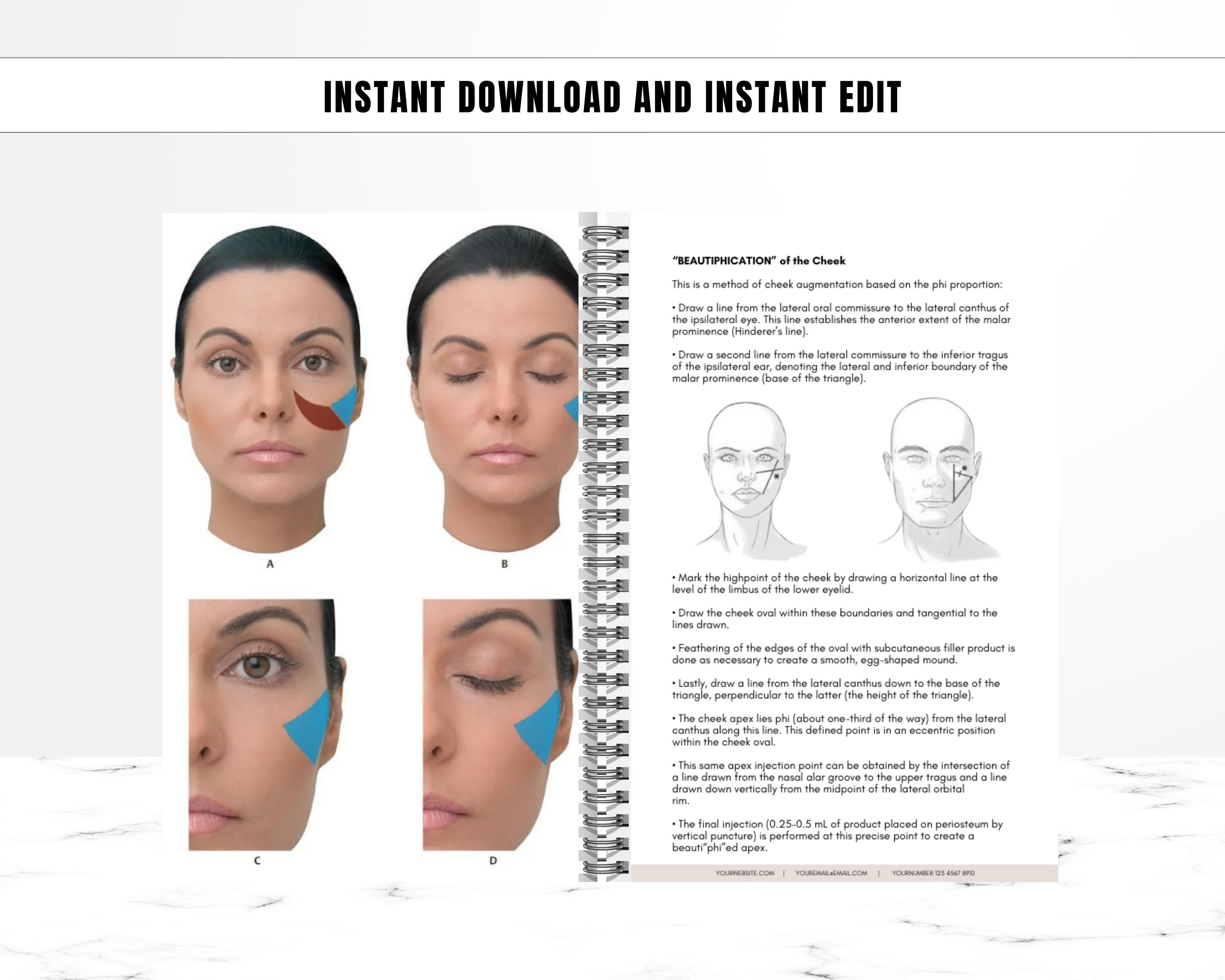 Advanced Cheek Augmentation Training Manual, Complete Guide, Fillers Training Guide, Dermal ...