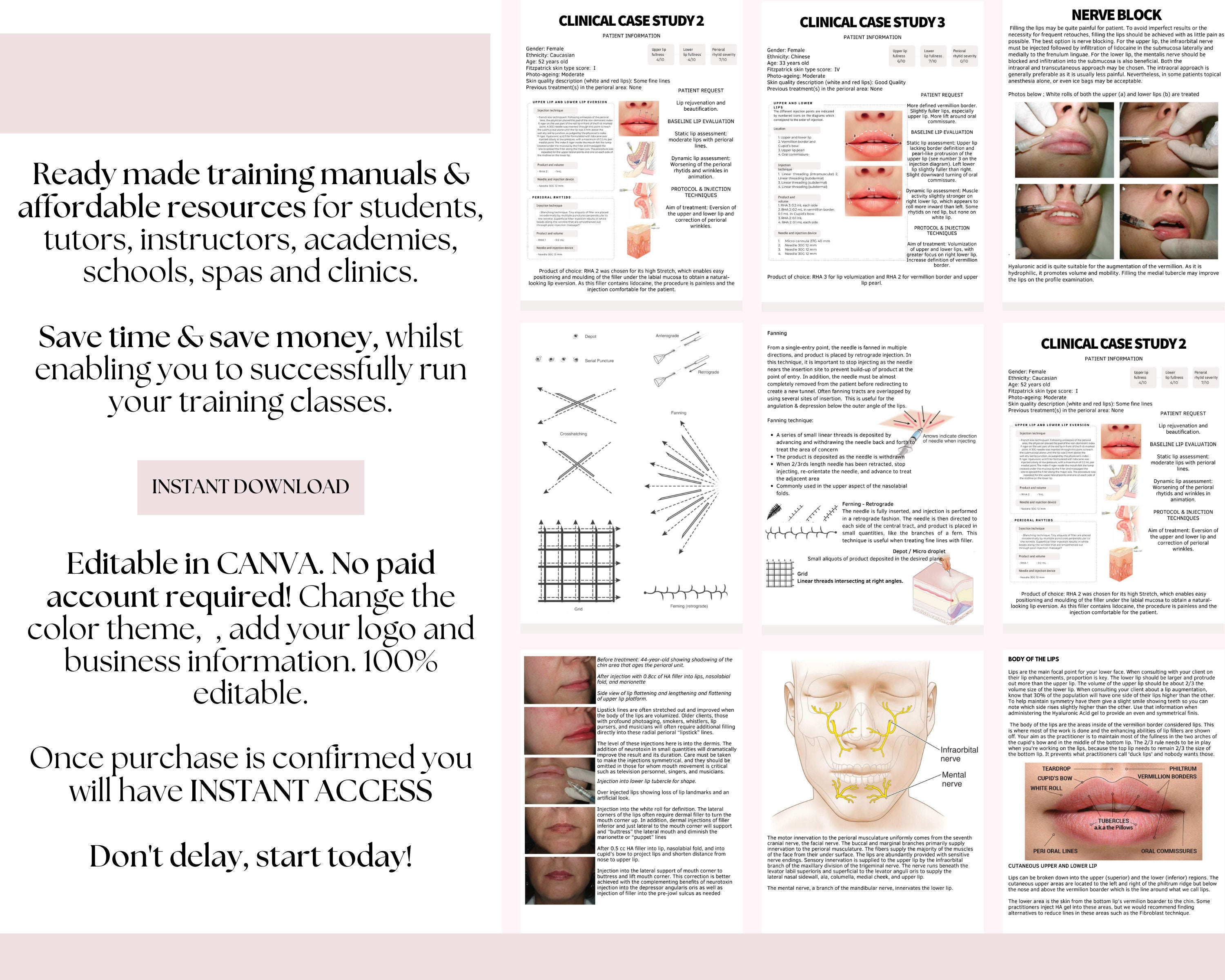 Lip Fillers Training Manual, Hyaluronic Acid, Lip Augmentation, Student ...