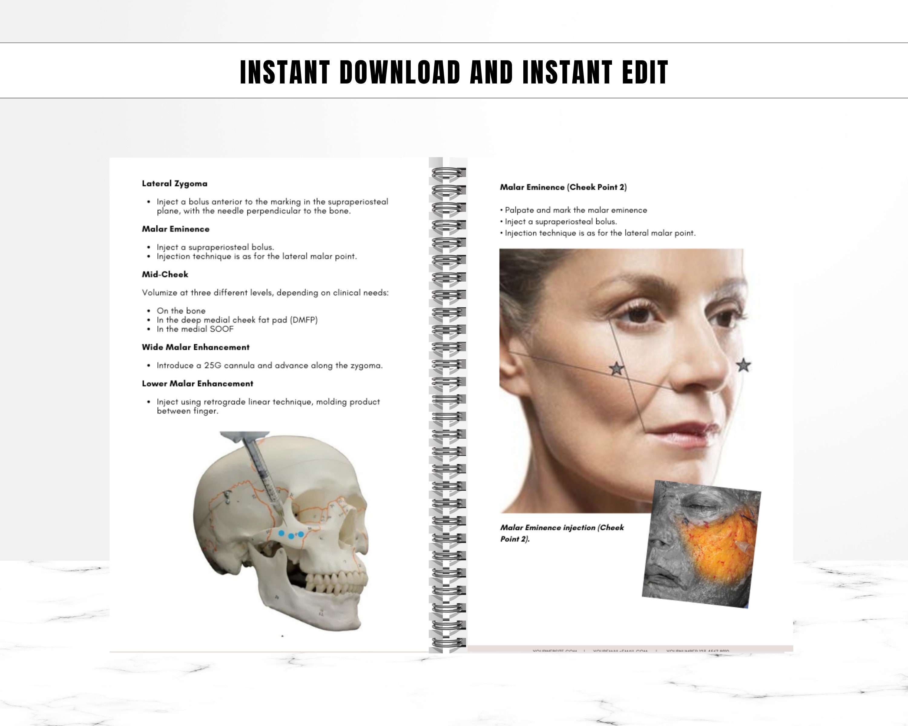Advanced Cheek Augmentation Training Manual, Complete Guide, Fillers ...