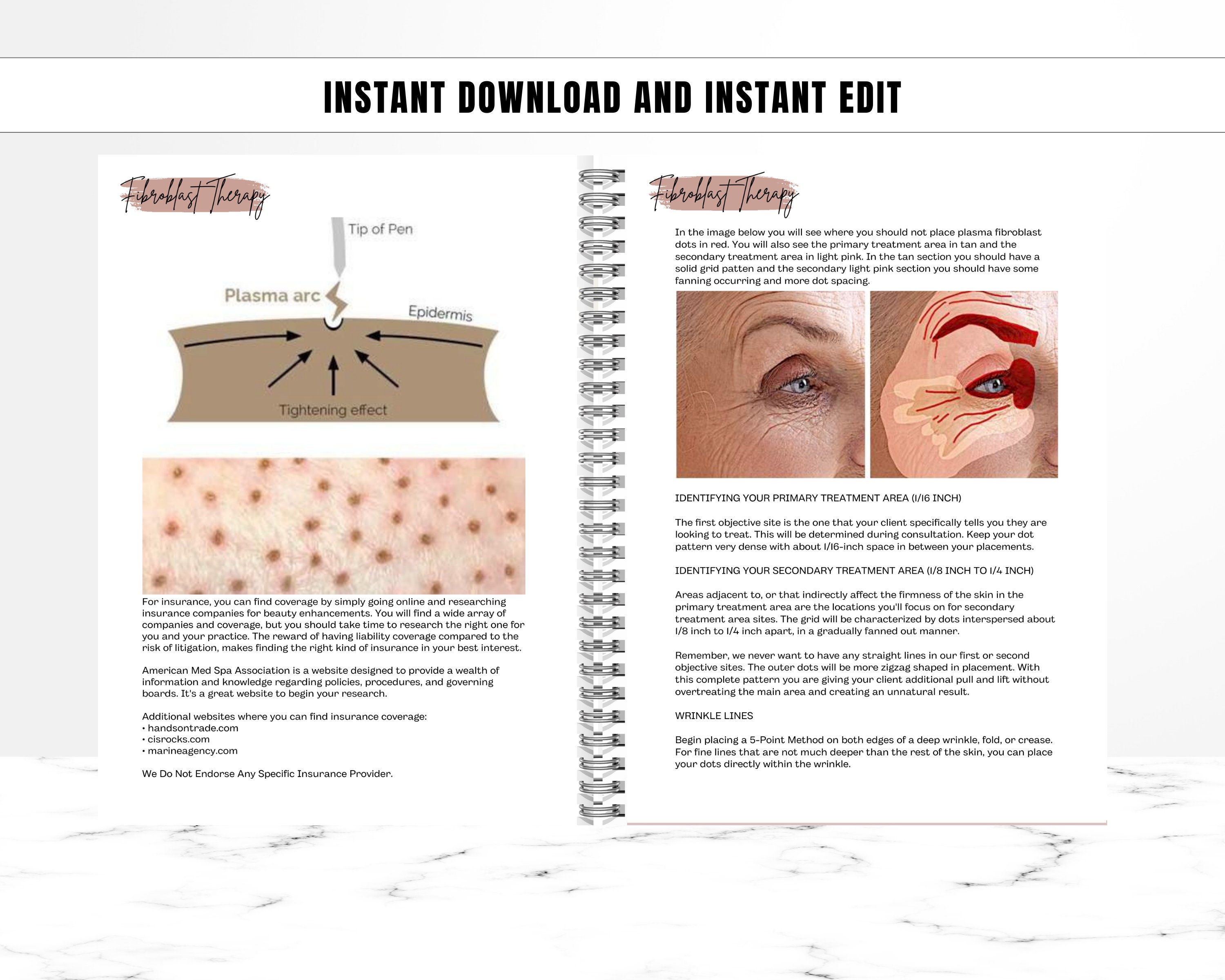Plasma Pen Fibroblast Therapy Training Manual, Editable Training Guide ... Plasma Pen Fibroblast Therapy Training Manual, Editable Training Guide ...