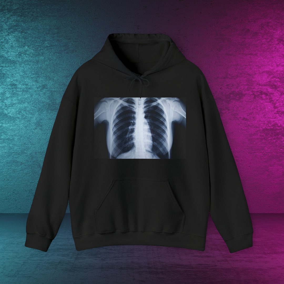Printed Front and Back X-RAY X-ray Sweater Hoodie Hoodie - Etsy