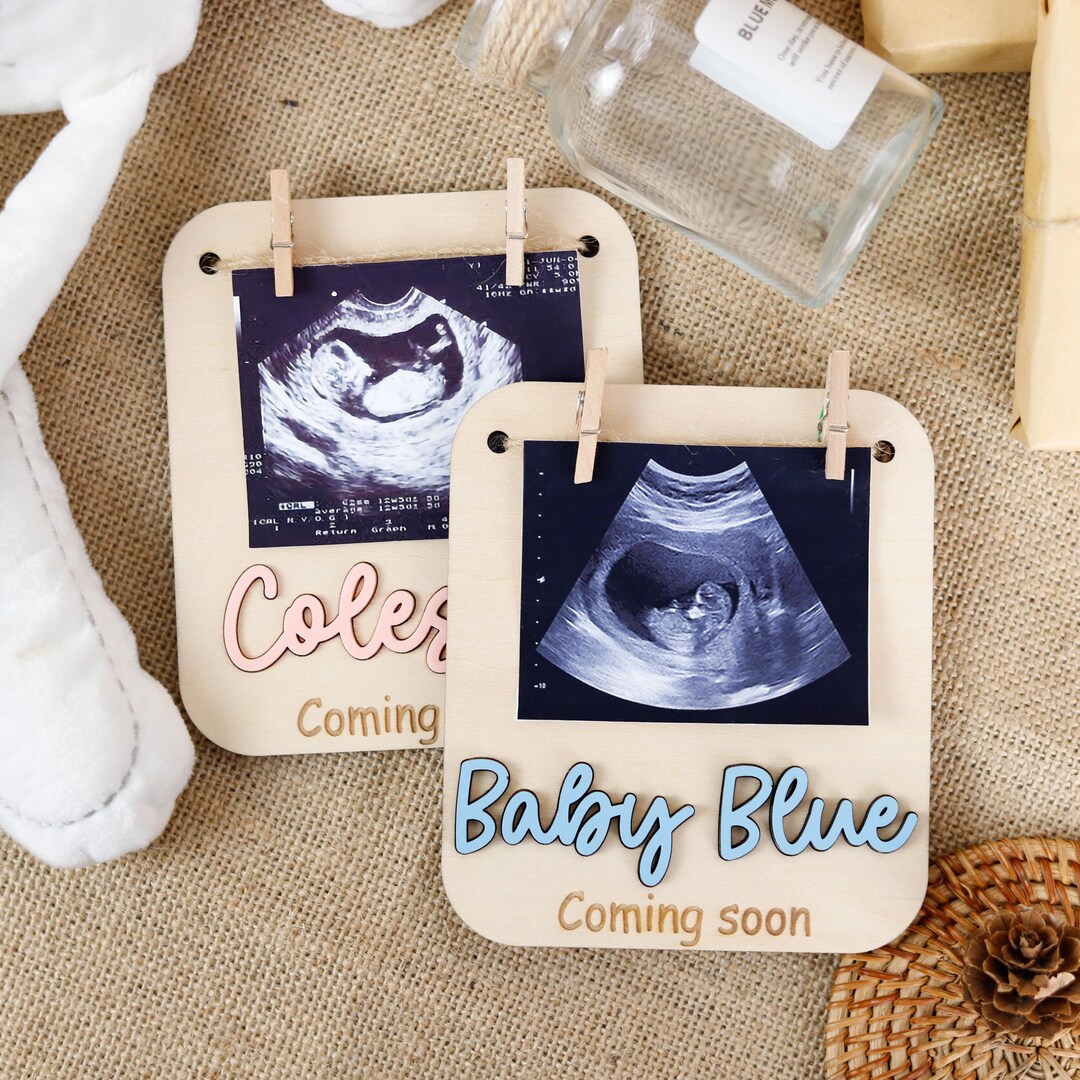 Baby Announcement Ultrasound Frame, Baby Coming Soon 2025 Picture Frame ...