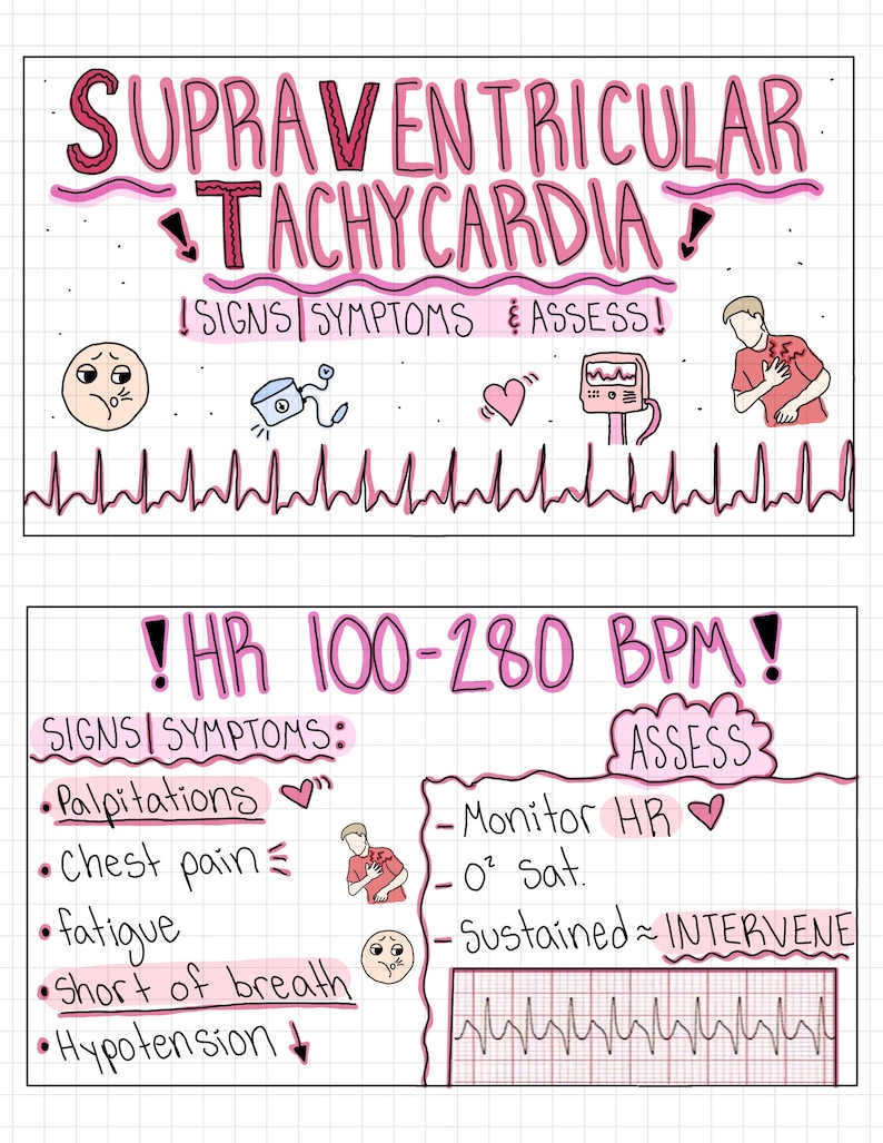 Cardiac Flash Cards (part 1) - 30 Cards - Etsy