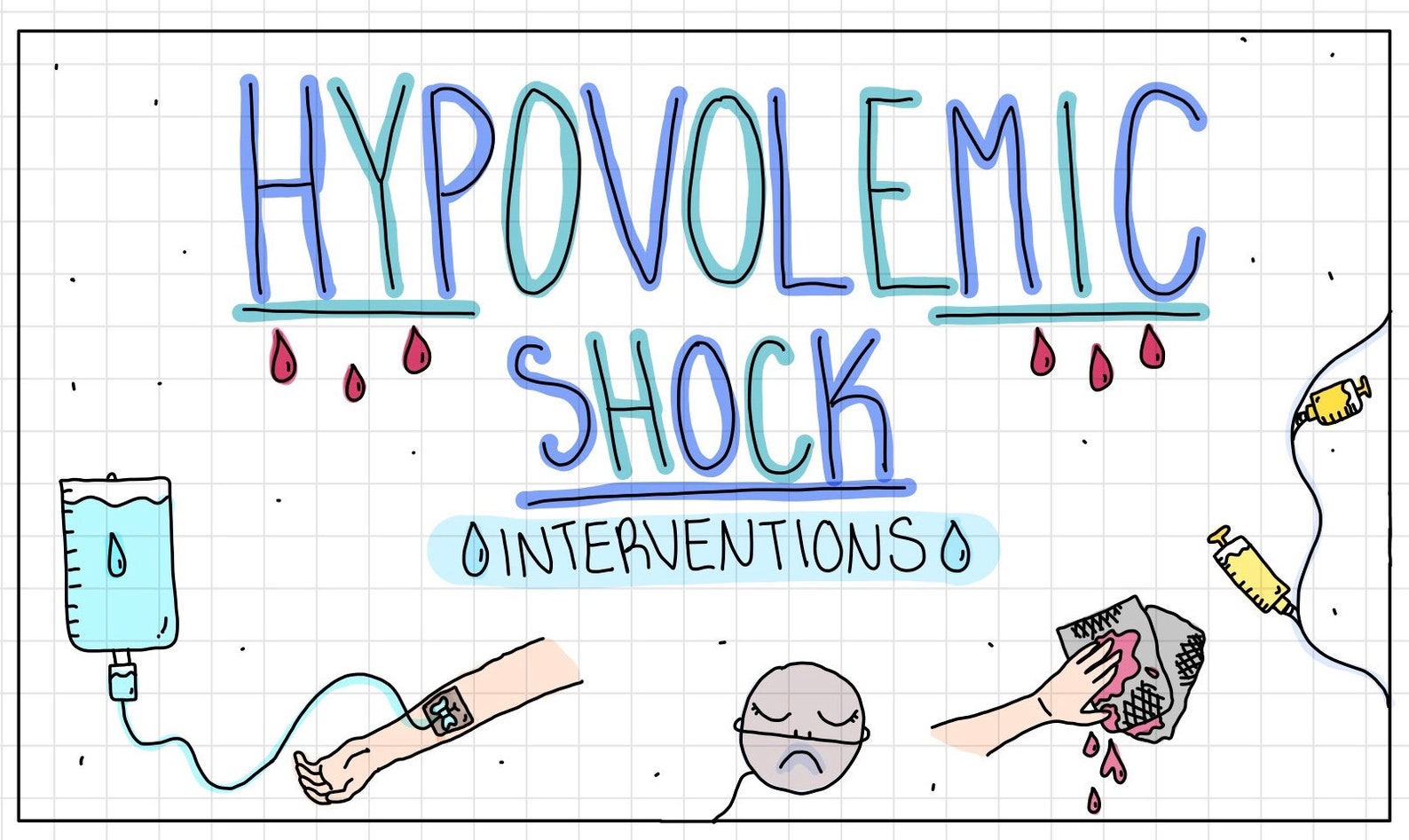 Cardiac Flash Cards (part 1) - 30 Cards - Etsy