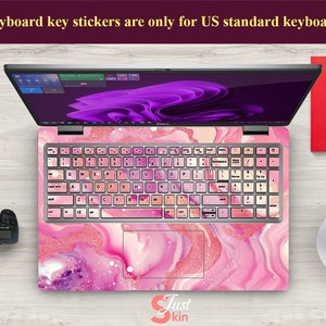 HP Laptop Skin Pink Pattern Design Unique Valentine's Day Gift Vinyl ...