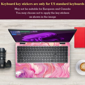 HP Laptop Skin Pink Pattern Design Unique Valentine's Day Gift Vinyl ...