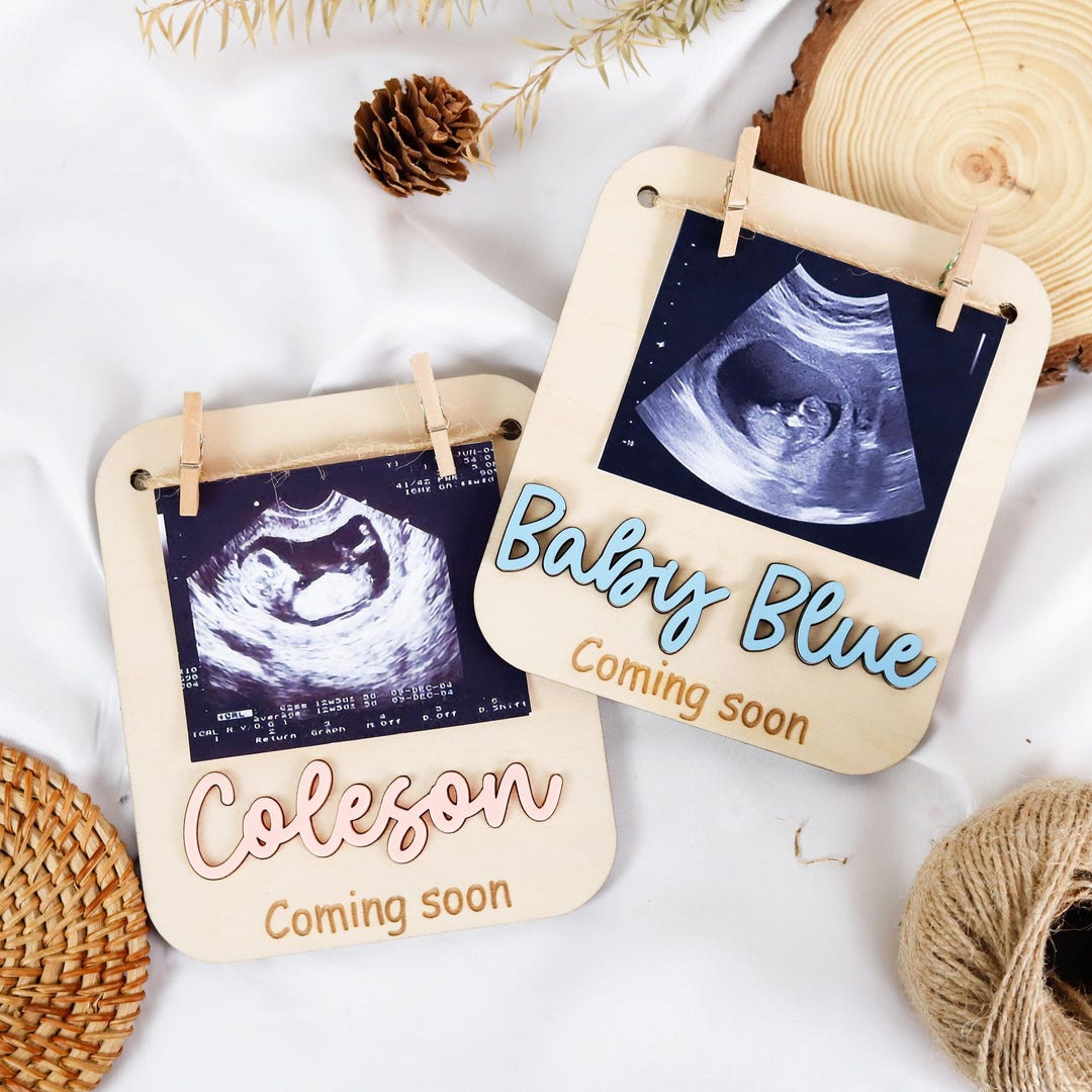 Custom Coming Soon Ultrasound Fridge Magnet, Ultrasound Magnetic Frame ...
