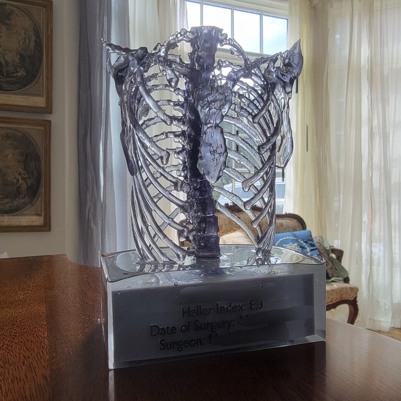 Haller Edition: Custom Thoracic Skeleton on a Solid Base Using Your CT ...