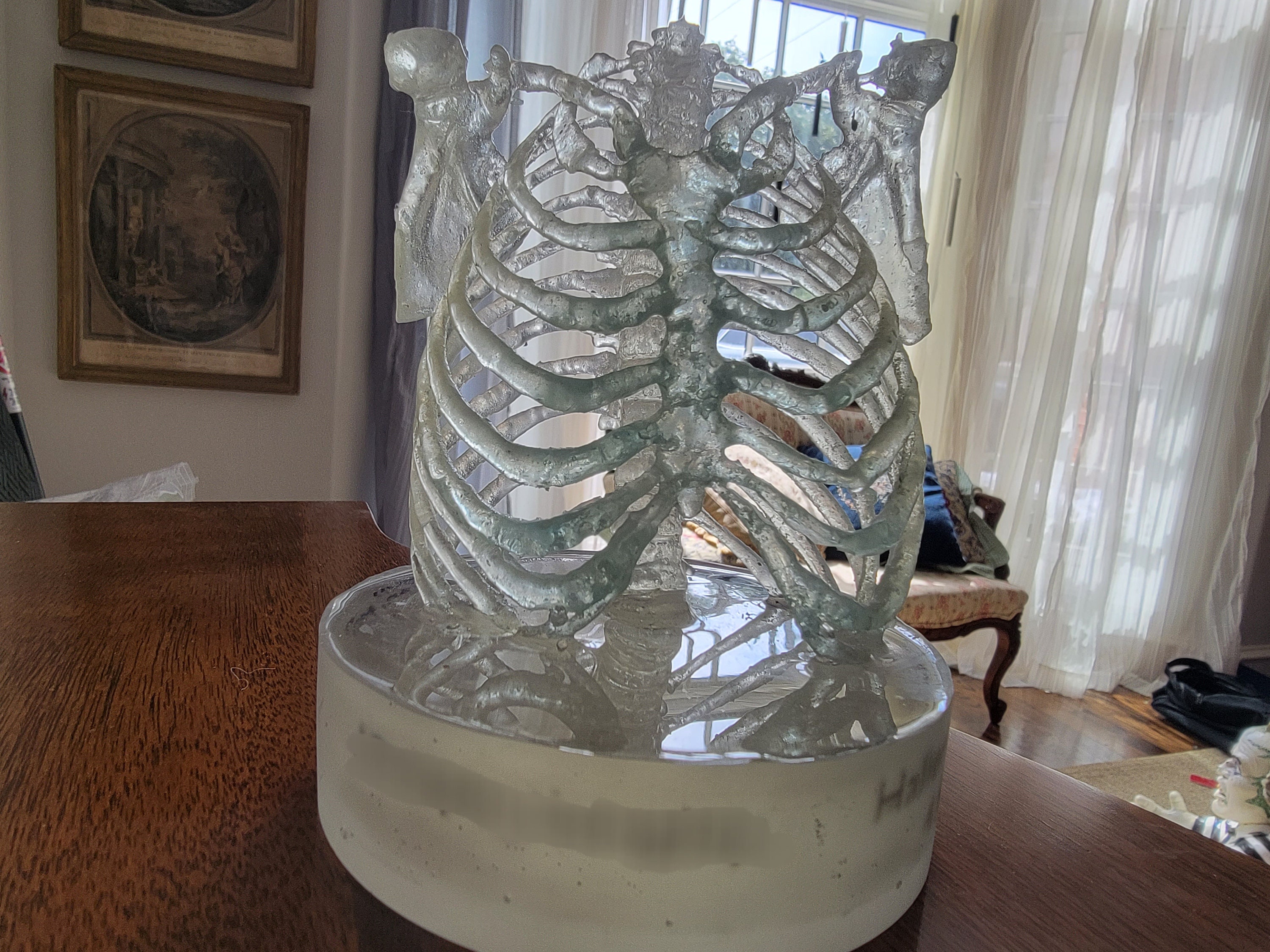 Haller Edition: Custom Thoracic Skeleton on a Solid Base Using Your CT ...