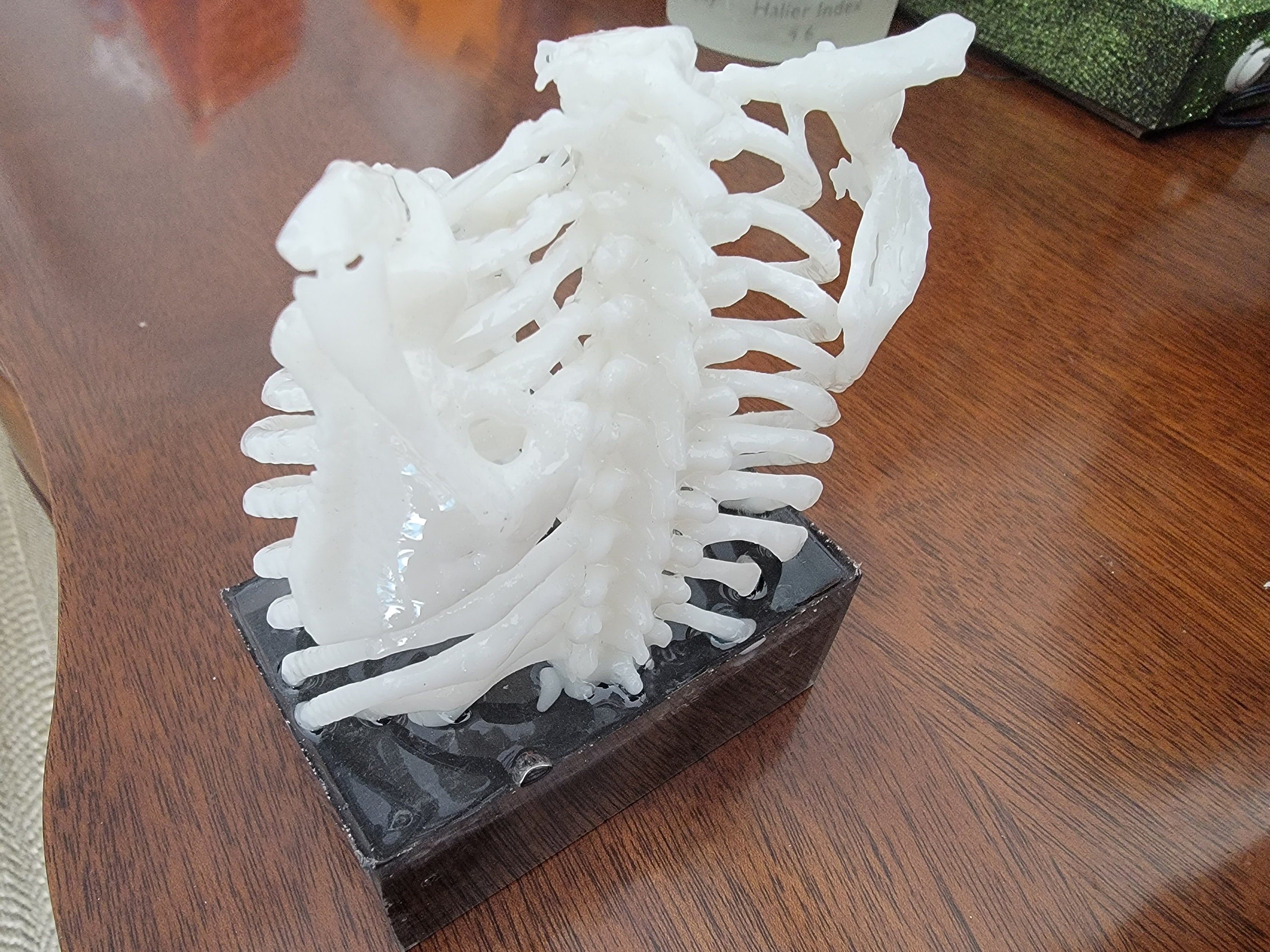 Haller Edition: Custom Thoracic Skeleton on a Solid Base Using Your CT ...