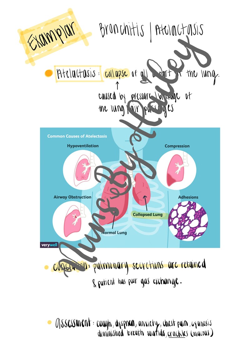 Gas Exchange & Respiratory Nursing Study Guide - Etsy