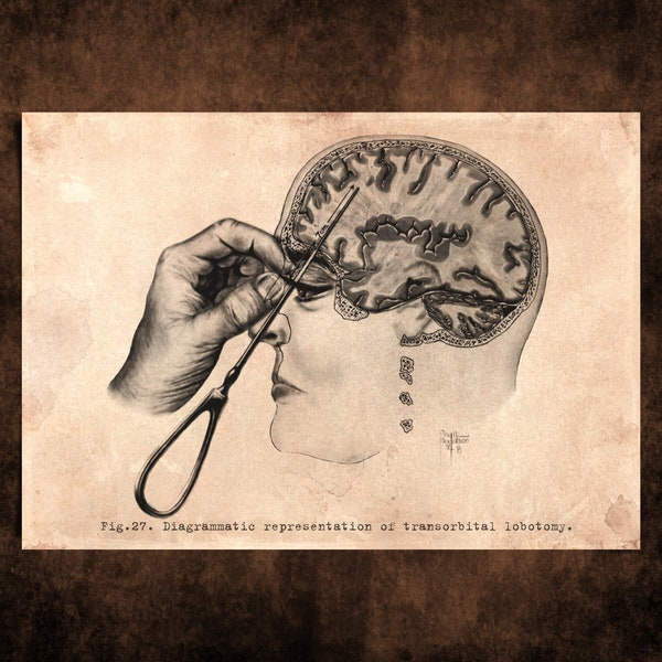 Lobotomy Tools - Etsy