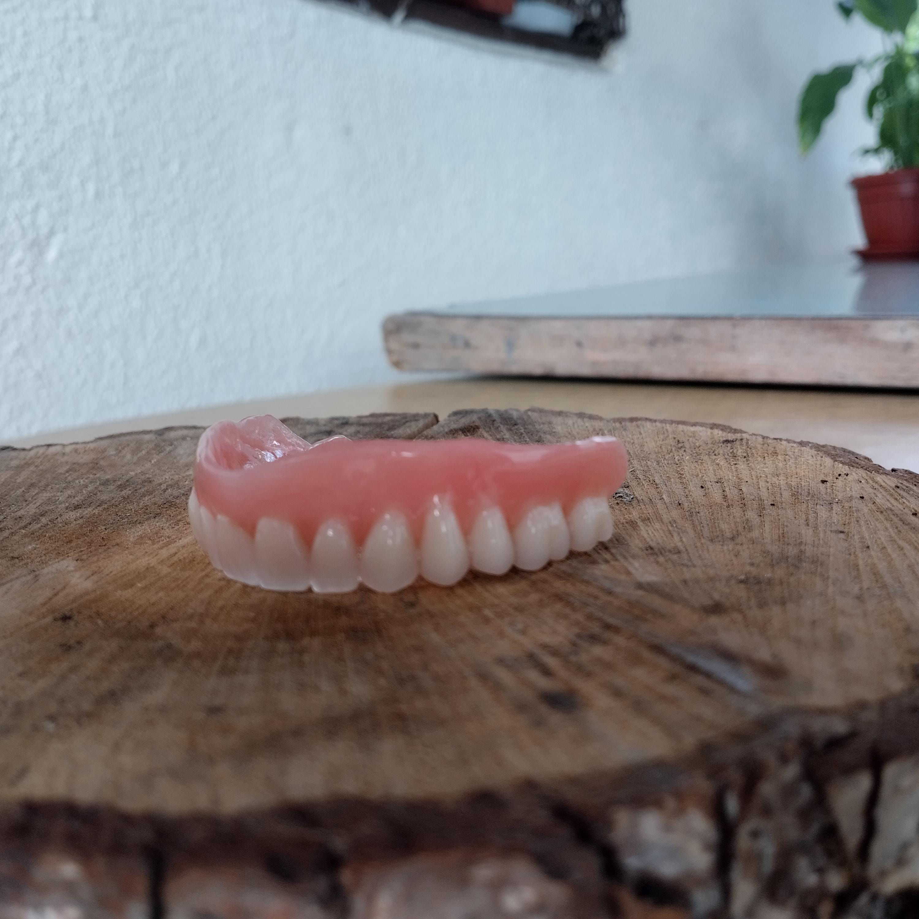 Upper Denture Horseshoe Style - Etsy UK