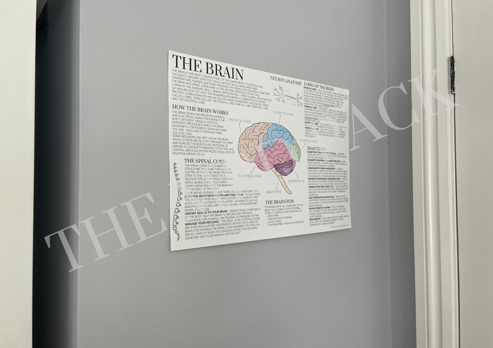 The Brain A3 Medical Notes Poster - Etsy