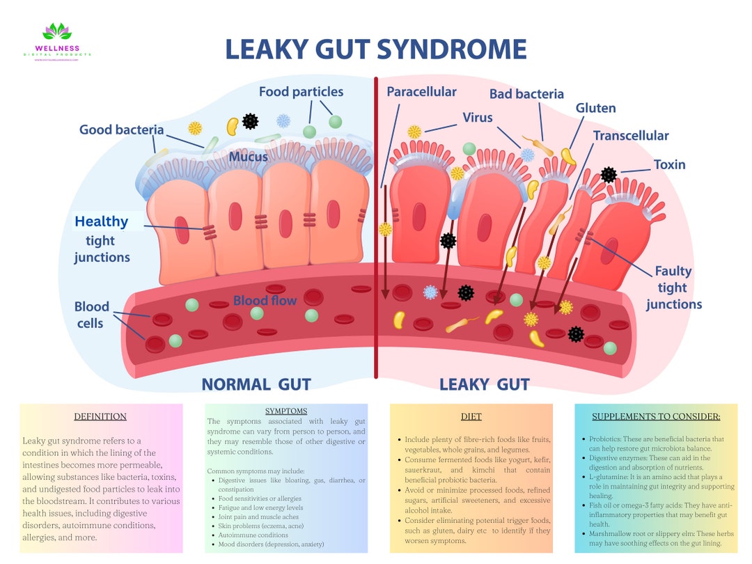 Leaky Gut Digital Poster - Etsy