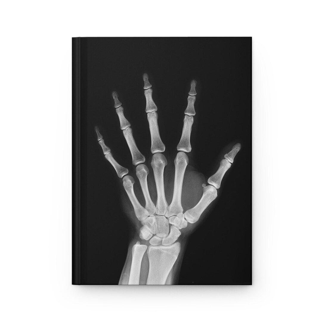 X-ray Vision Skeleton Notebook - Bone Journal With Hand X-ray Print ...
