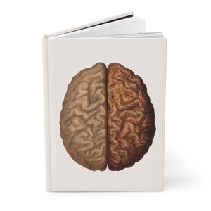 Vintage Anatomical Illustration Human Brain Notebook - Brain Journal ...