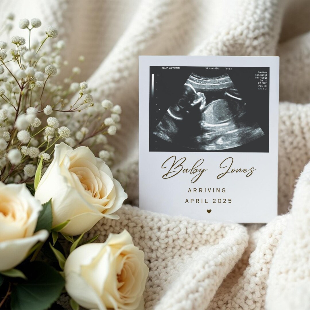 Neutral Pregnancy Announcement Template | Editable Digital Pregnancy ...