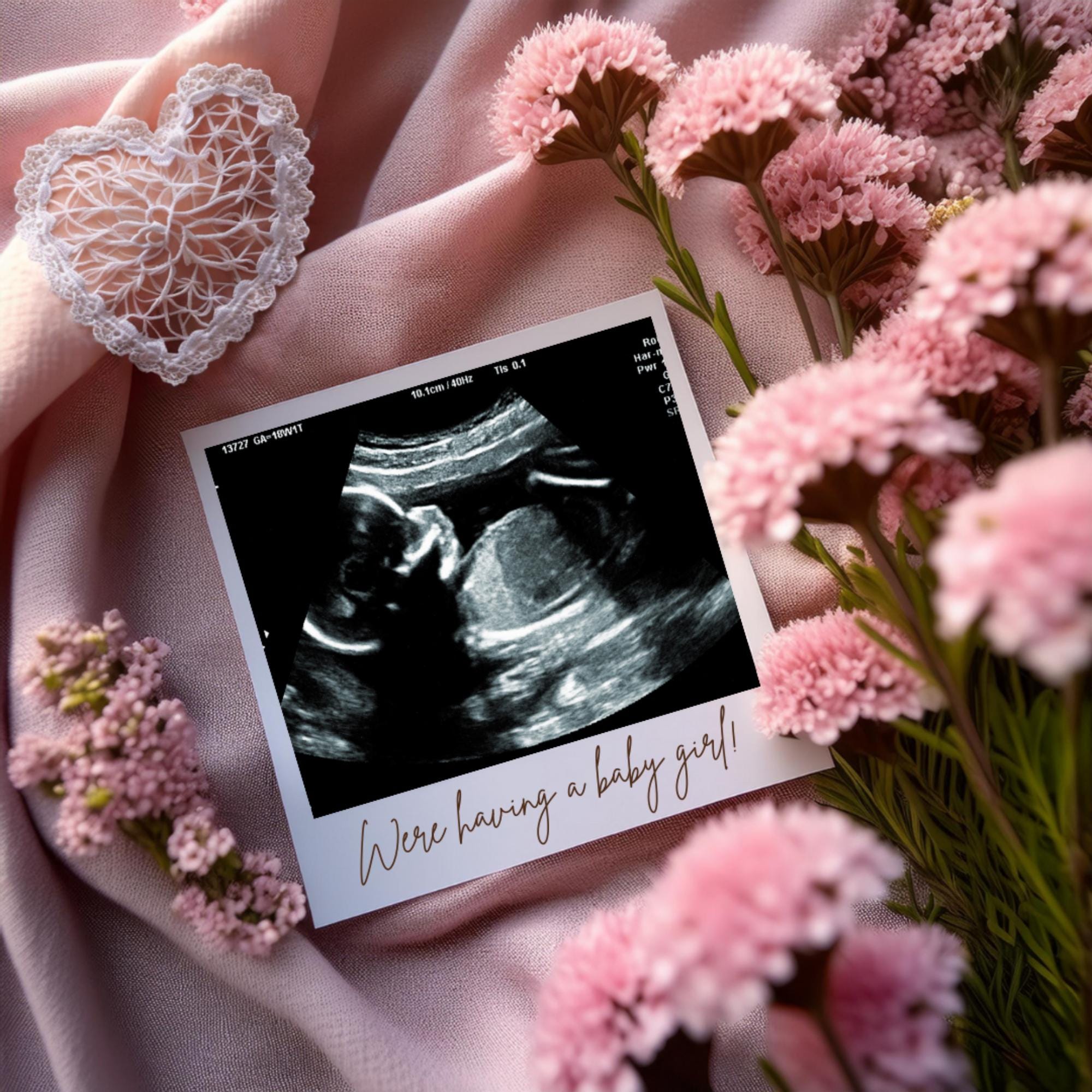 Were Having A Baby Girl Pregnancy Announcement Digital Baby Girl Reveal ...