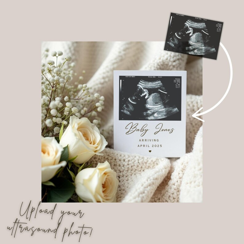 Neutral Pregnancy Announcement Template | Editable Digital Pregnancy ...