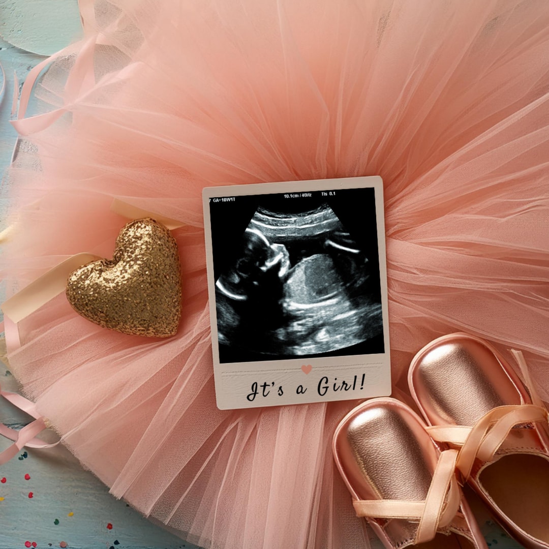 It's A Girl Pregnancy Announcement Digital | Baby Girl Gender Reveal ...