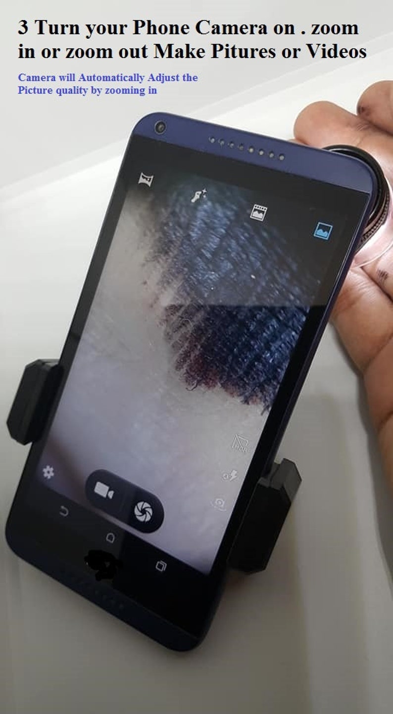 Handyscope Digital Dermoscopy Skin Diagnosis Dermatoscope Scabies ...