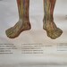Vintage Anatomical Poster, Lymph Nodes Diagram, Large Poster, Human ...