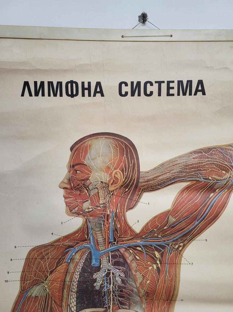 Vintage Anatomical Poster, Lymph Nodes Diagram, Large Poster, Human ...