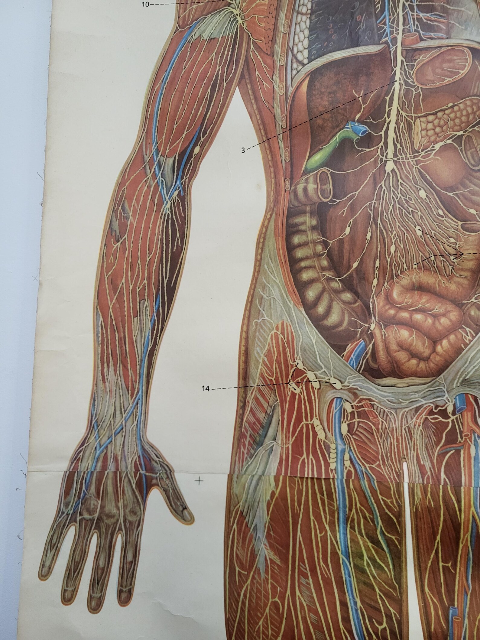 Vintage Anatomical Poster, Lymph Nodes Diagram, Large Poster, Human ...