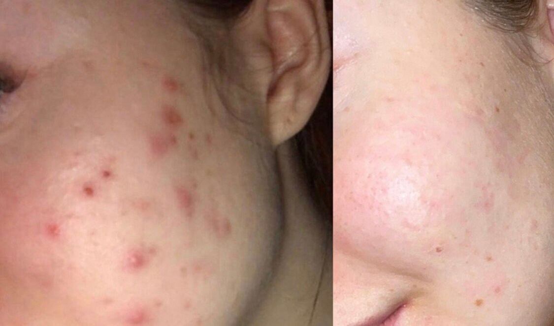 TURMERIC BODY Scrub/free Shipping/brightening Scrub/turmeric/turmeric ...