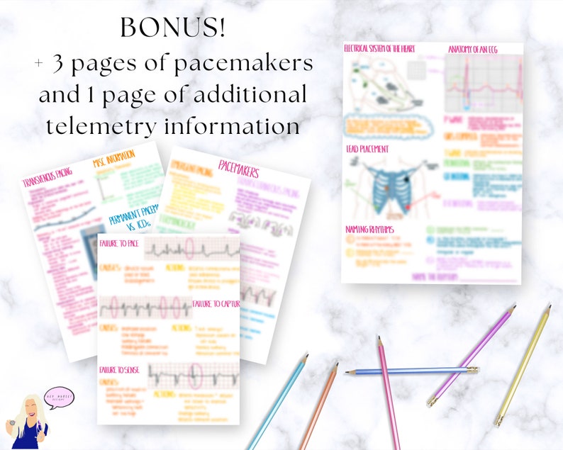 Instant Download Telemetry Tele Cardiac Rhythm Strip Flashcards ...