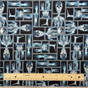 Skeleton X-ray Fabric - Anatomy - 100% Cotton - Xray Technician Medical ...