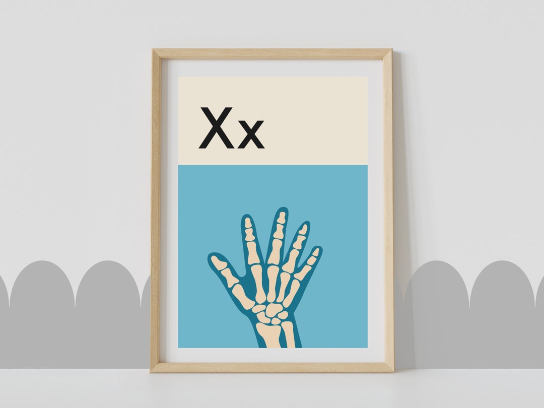 Letter X Alphabet Poster X is for Xray Learn ABC Print Nursery Decor ...
