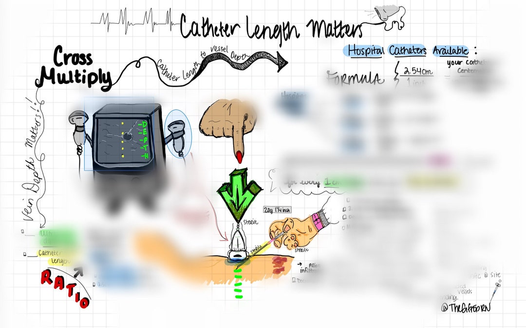 Vascular Access USGPIV Illustration View for Training - Etsy