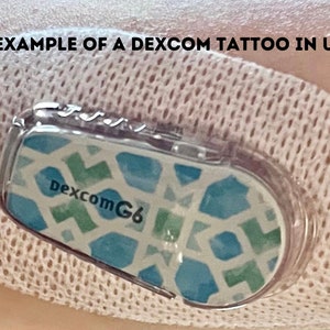 Dexcom G7 Tattoo Decal Accassorie for GCM Zigzag - Etsy
