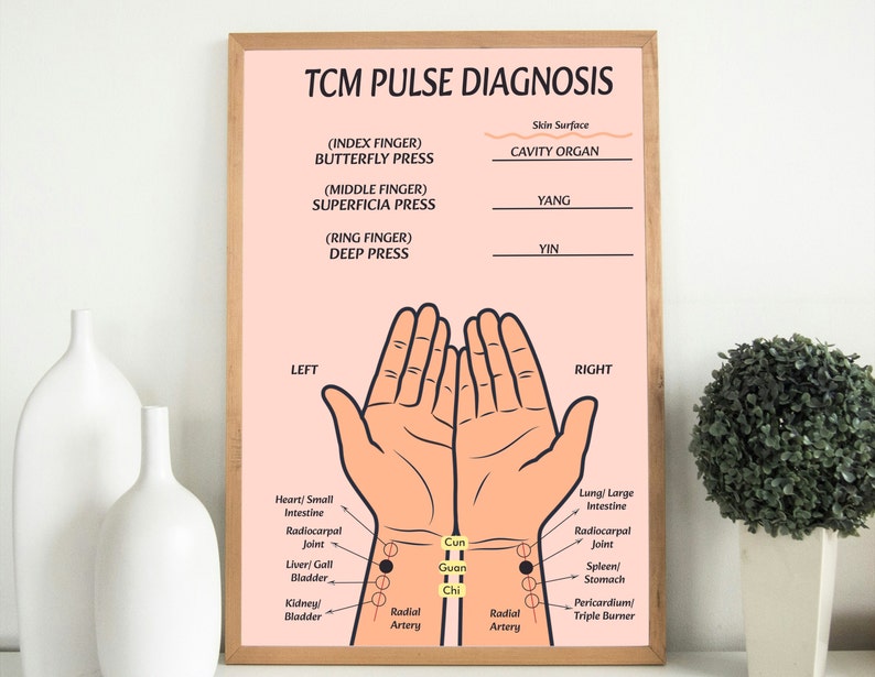 TCM Pulse Diagnosis Chart: Acupuncture Poster, Chinese Medicine Art ...