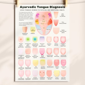 Ayurveda Tongue Diagnosis Poster, Ayurveda Tongue Chart, Ayurveda Art ...