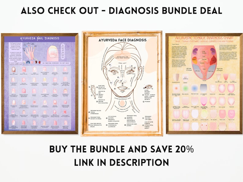 Ayurveda Marma Point Poster, Hands and Feet, Ayurveda Energy Points ...